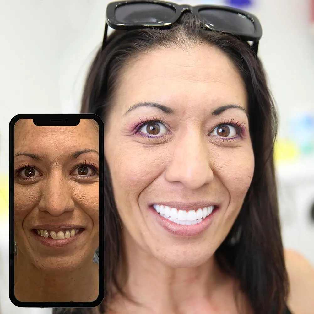 Bionic Smile: Congratulations on making the first step!